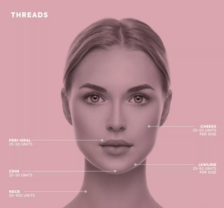 Thread Lift Gold Coast - Cog, PDO Threads Price Gold Coast | Skin to Soul